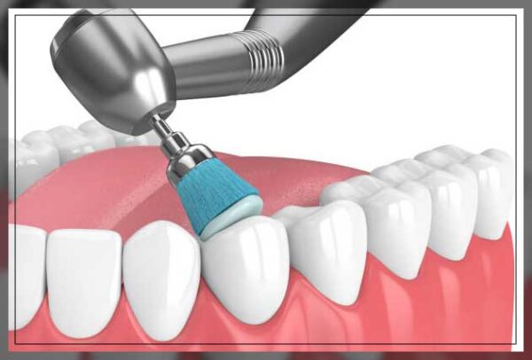 Dental Handpiece: Use, Types and Parts - Engiomed