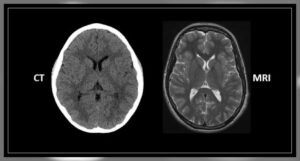 CT Scan vs. MRI: What are the Differences? - Engiomed