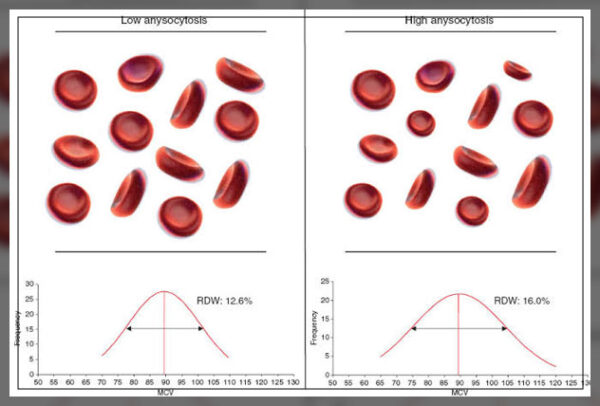 RDW Blood Test: What is Red Cell Distribution Width Test? - Engiomed